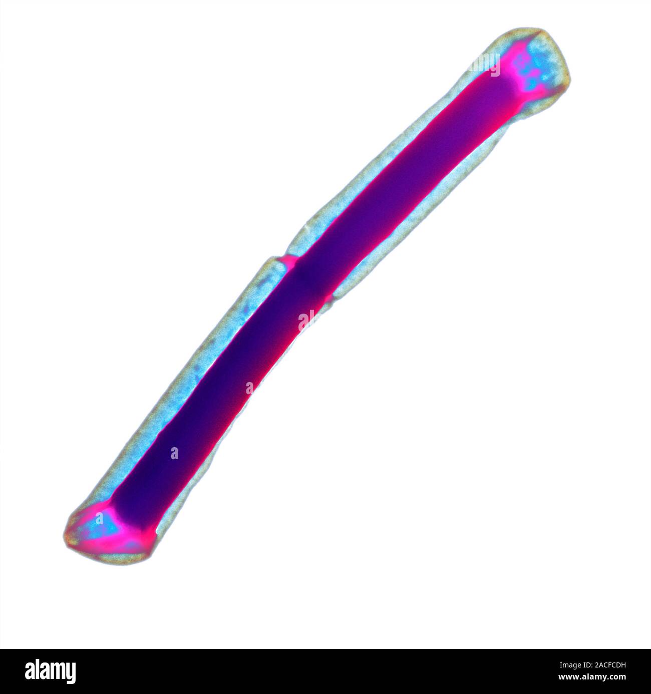 Clostridium difficile bacteria, coloured transmission electron ...