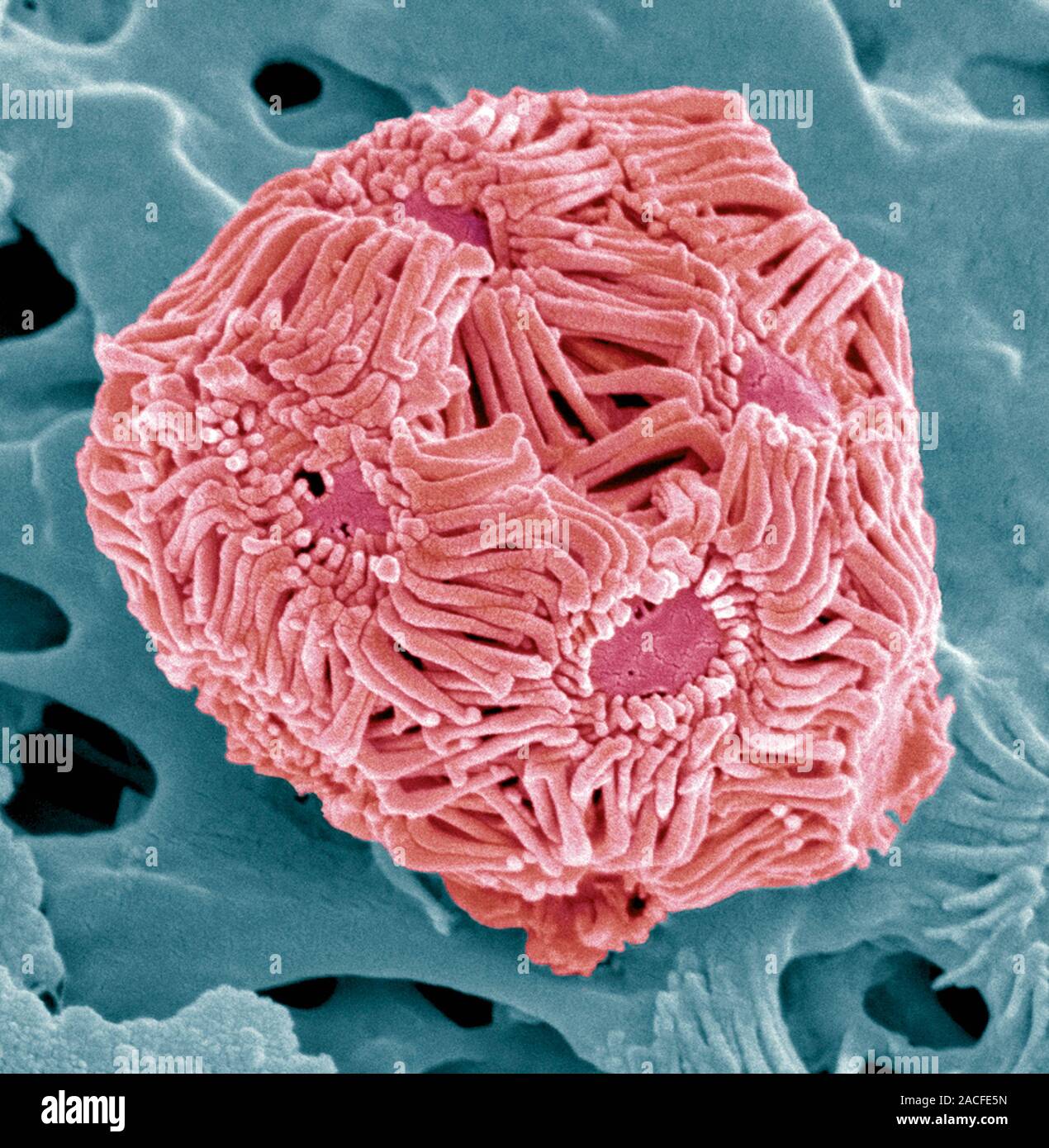 Calcareous phytoplankton. Coloured scanning electron micrograph (SEM ...