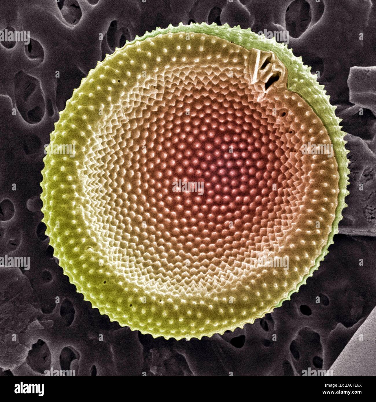 Dinoflagellate. Coloured scanning electron micrograph (SEM) of the ...