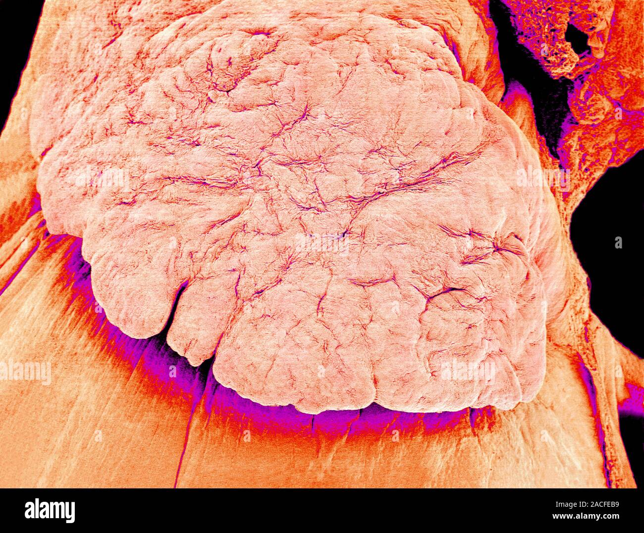Right atrial appendage of the heart (centre), coloured scanning ...