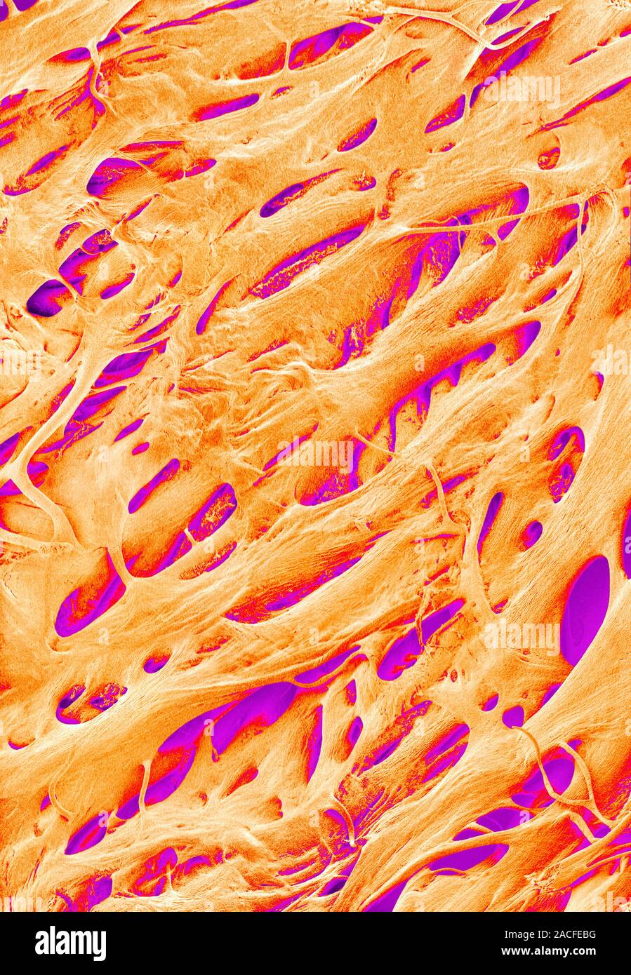 Trabeculae carneae in the left ventricle of the heart, coloured ...