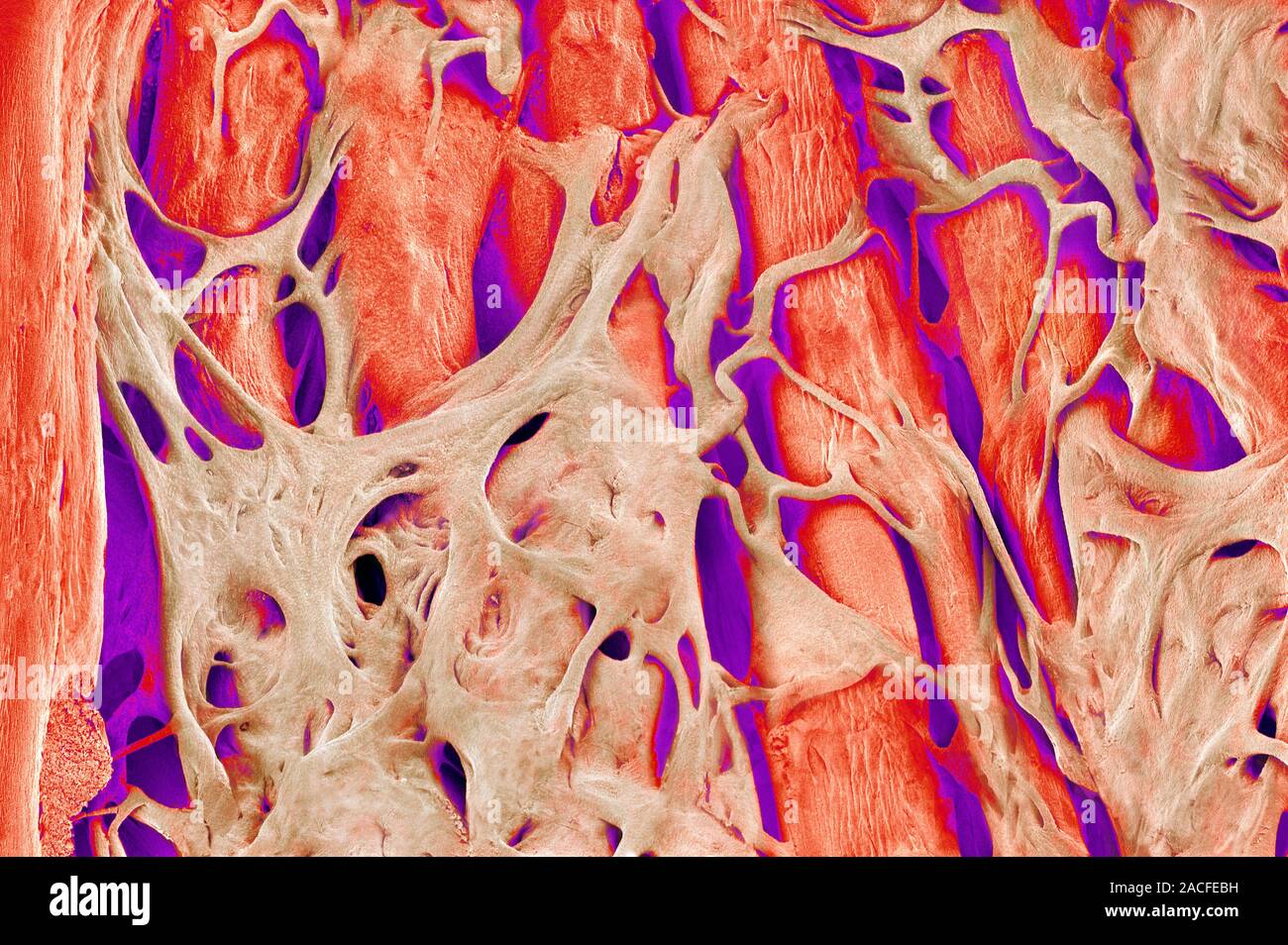 Trabeculae Carneae Histology