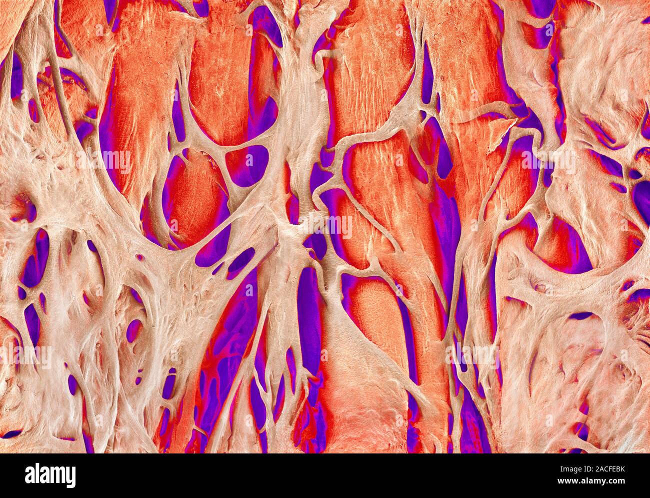Trabeculae carneae in the left ventricle of the heart, coloured ...
