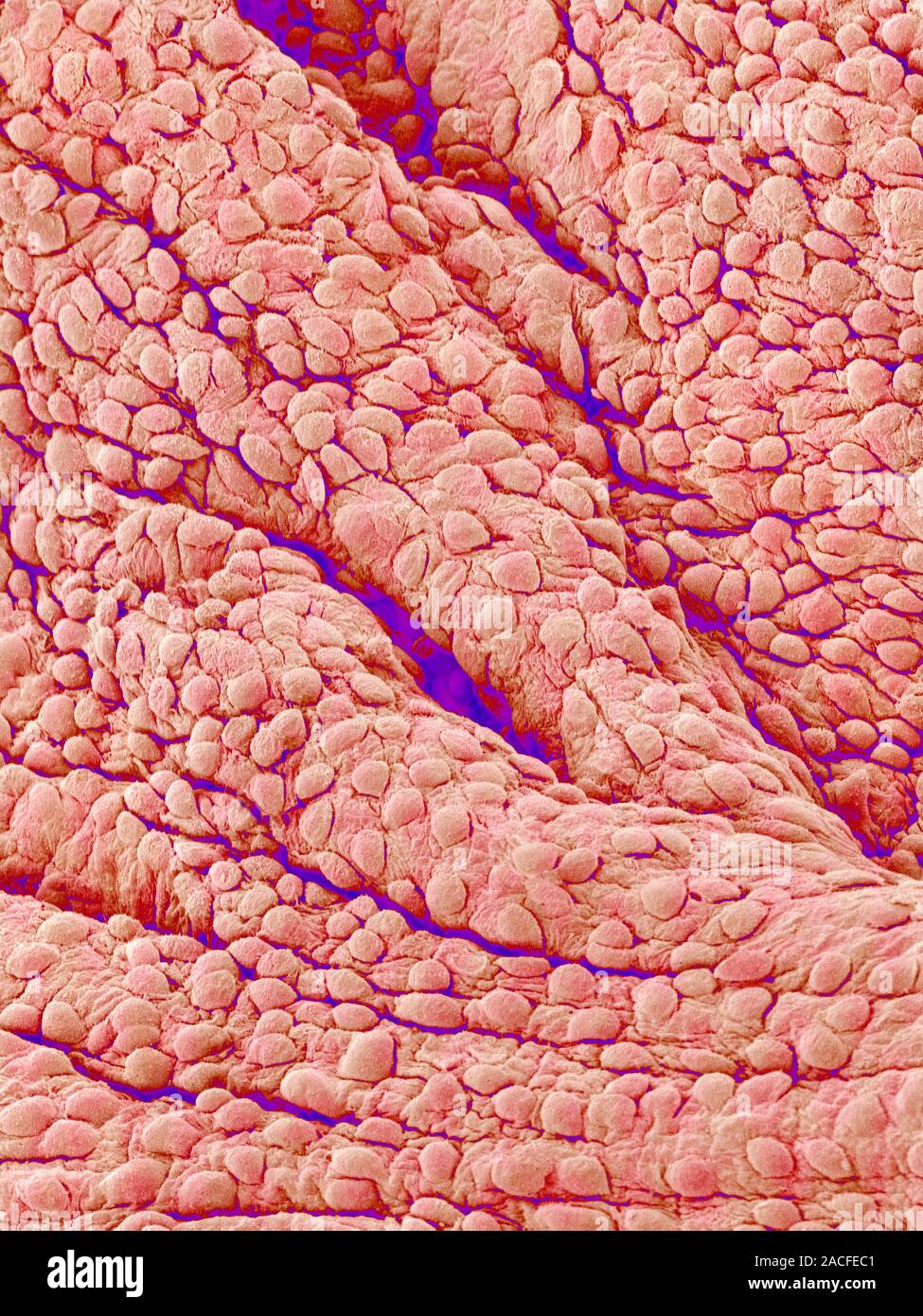 Heart valve surface, coloured scanning electron micrograph (SEM). Heart ...