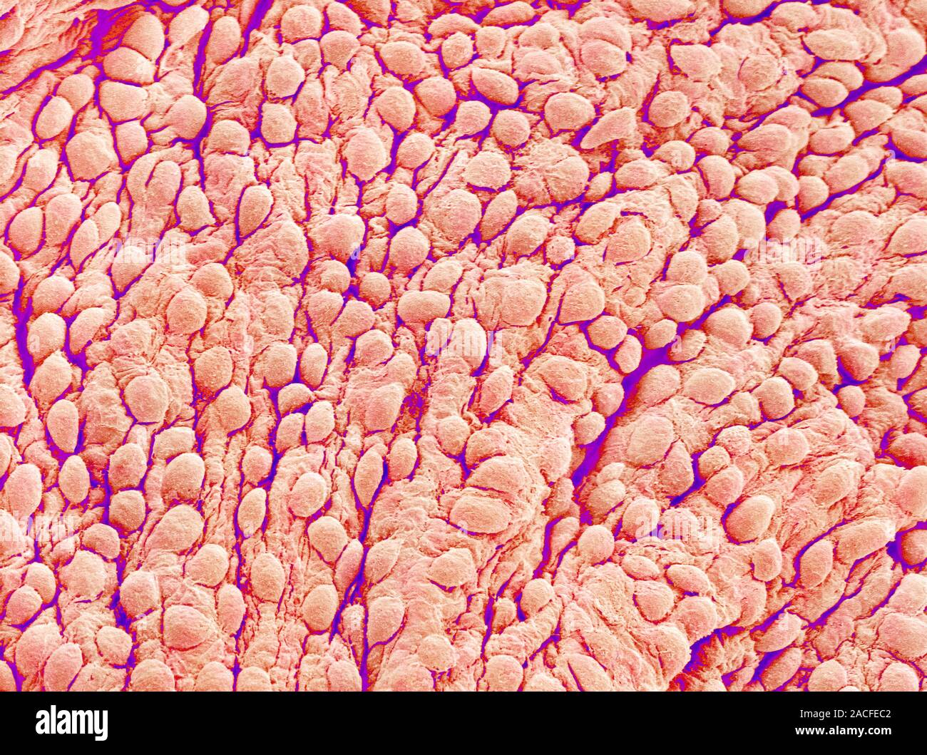 Heart valve surface, coloured scanning electron micrograph (SEM). Heart ...