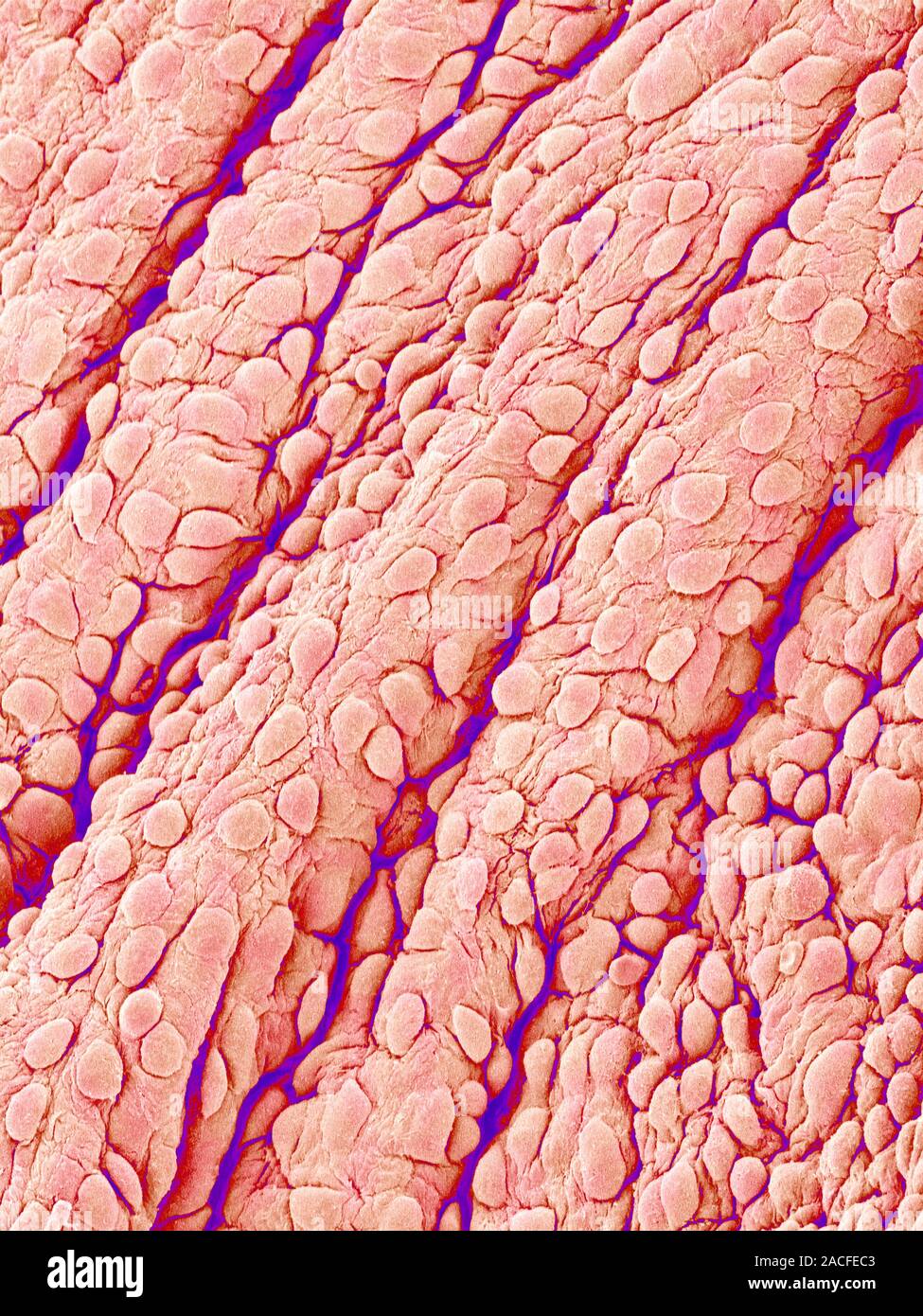 Heart valve surface, coloured scanning electron micrograph (SEM). Heart ...