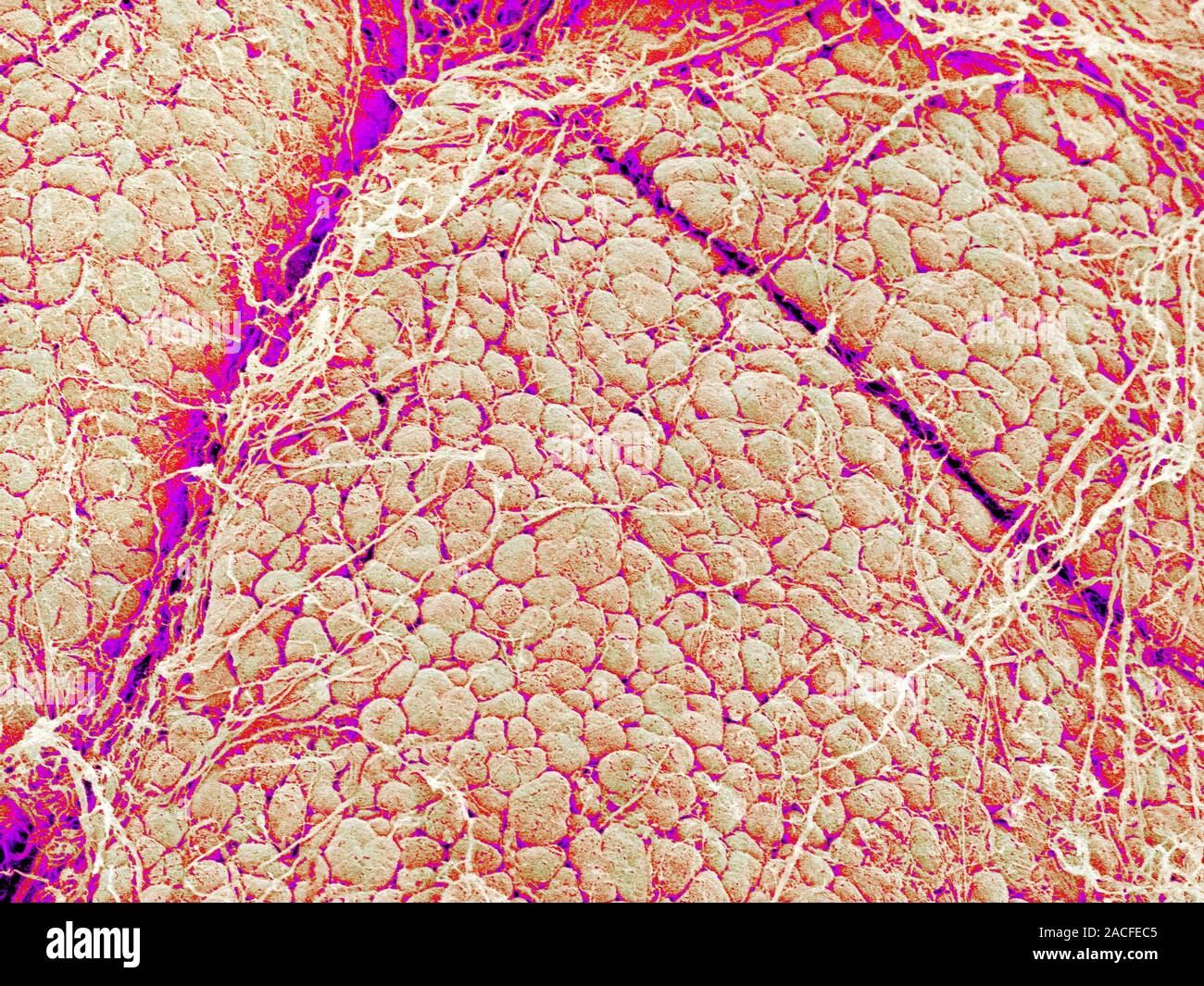 Pancreas surface, coloured scanning electron micrograph (SEM). Several ...