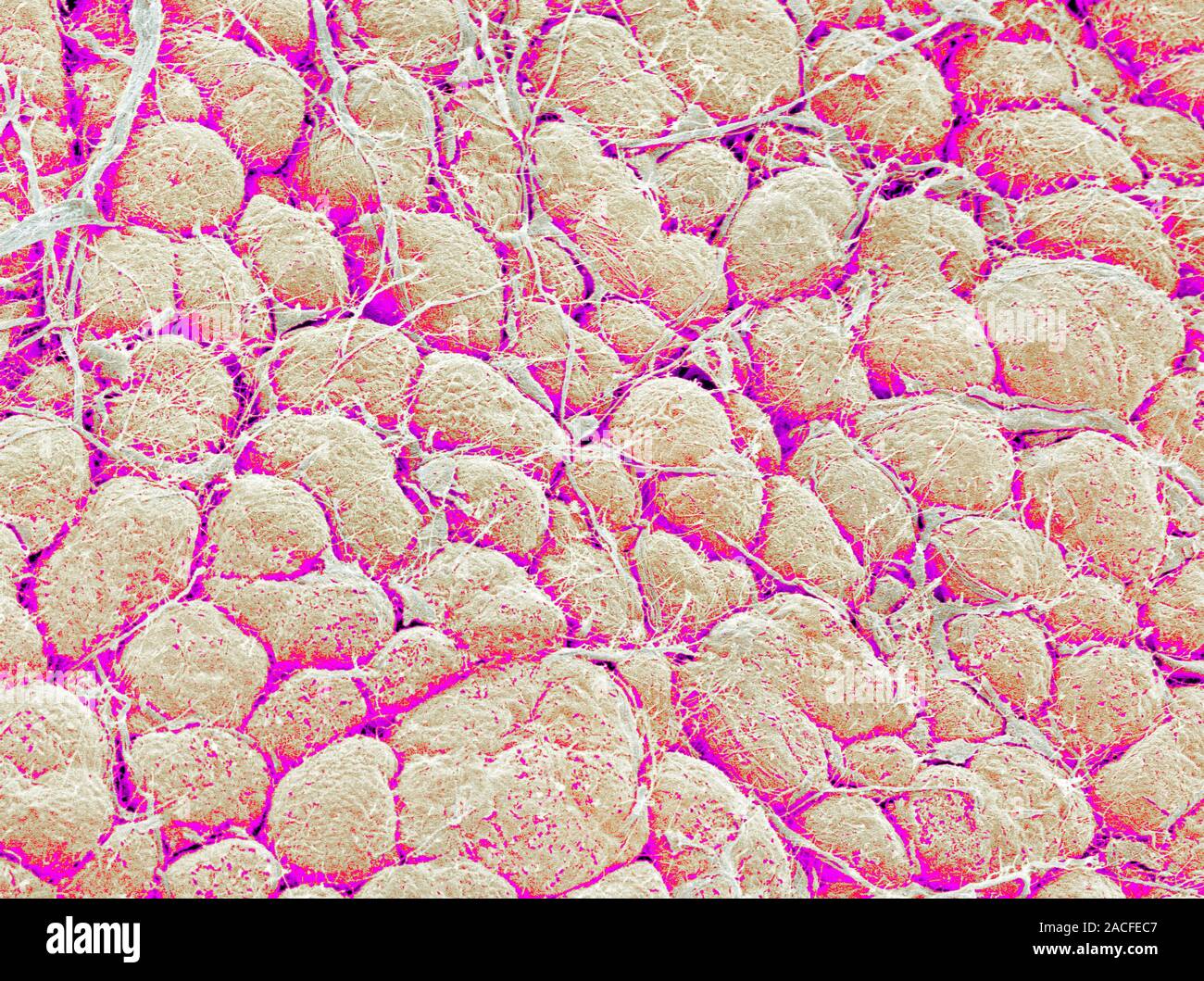 Pancreas surface, coloured scanning electron micrograph (SEM). The ...