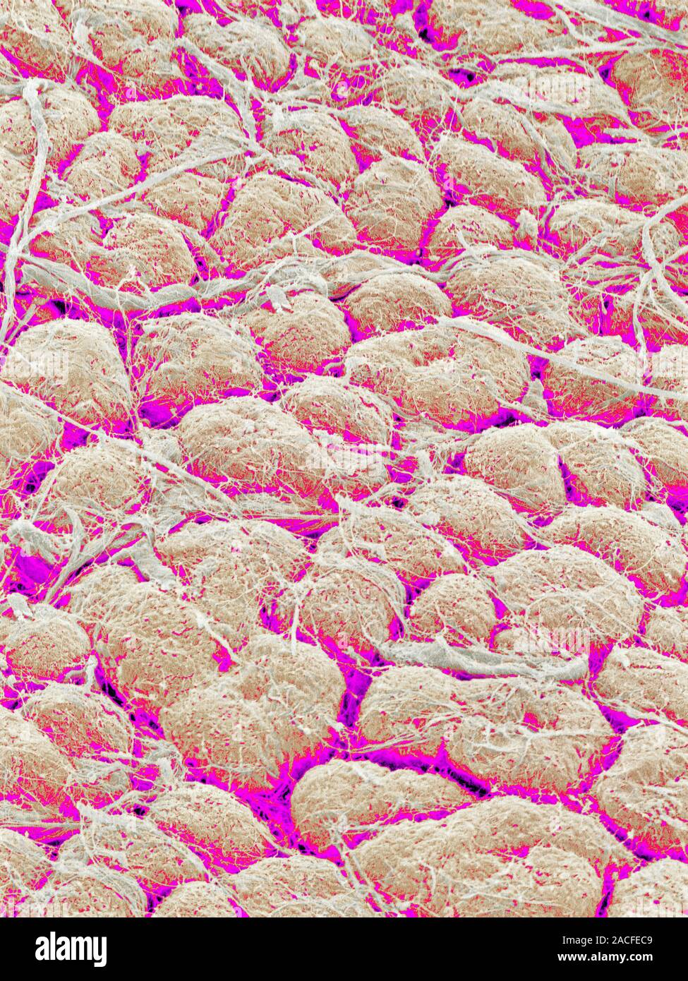 Pancreas surface, coloured scanning electron micrograph (SEM). The ...