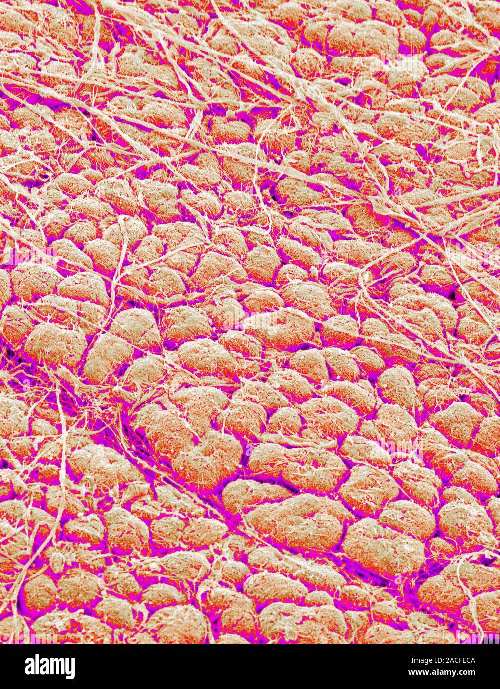 Pancreas surface, coloured scanning electron micrograph (SEM). The ...