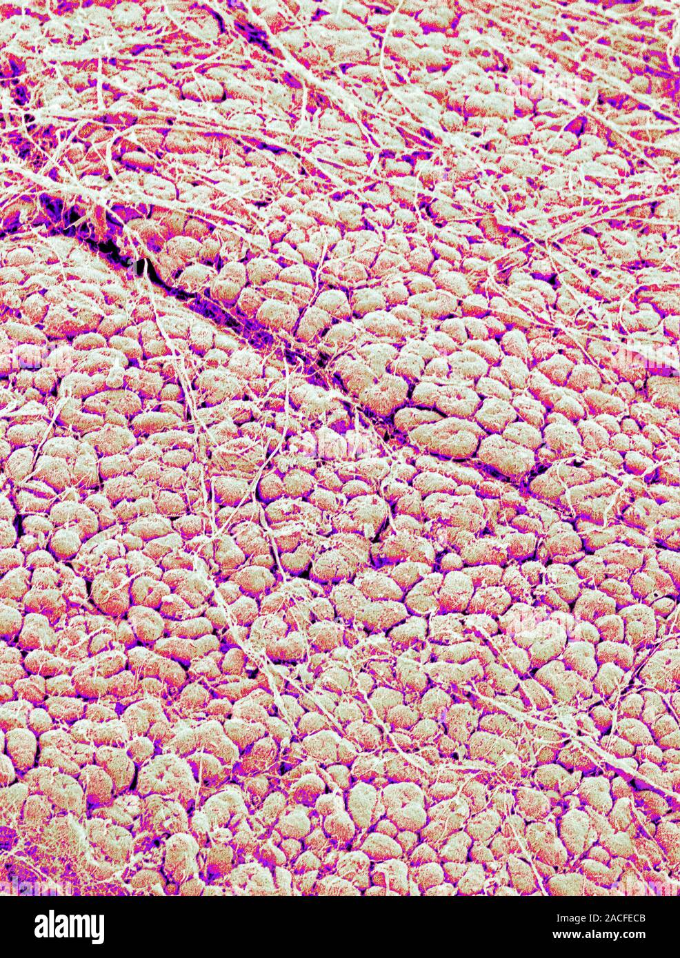 Pancreas surface, coloured scanning electron micrograph (SEM). The ...