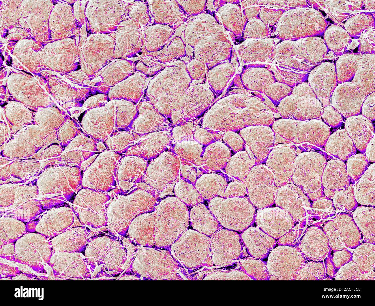 Pancreas surface, coloured scanning electron micrograph (SEM). The ...