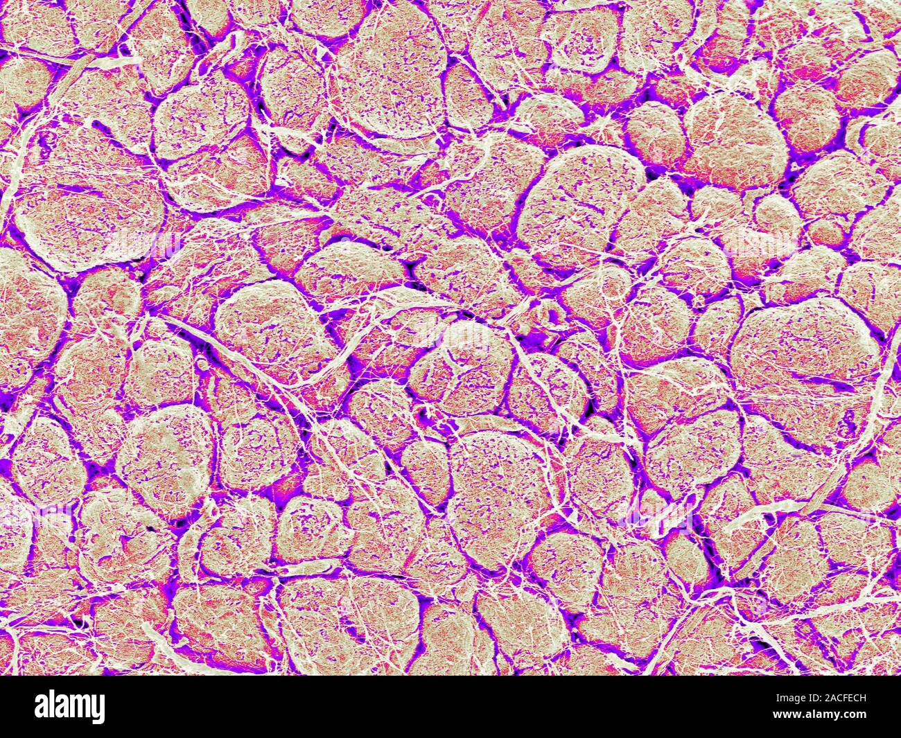 Pancreas surface, coloured scanning electron micrograph (SEM). The ...