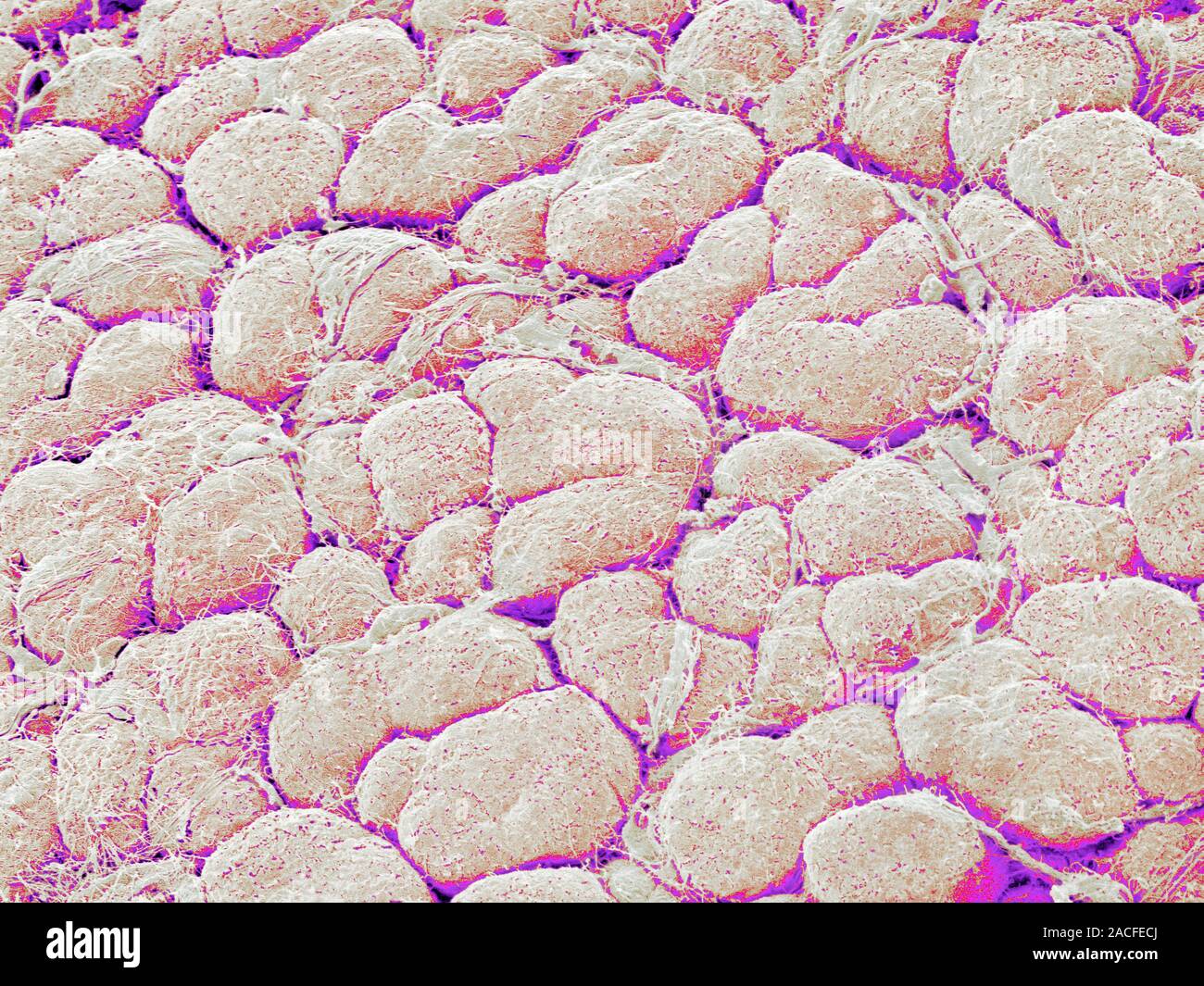 Pancreas surface, coloured scanning electron micrograph (SEM). The ...