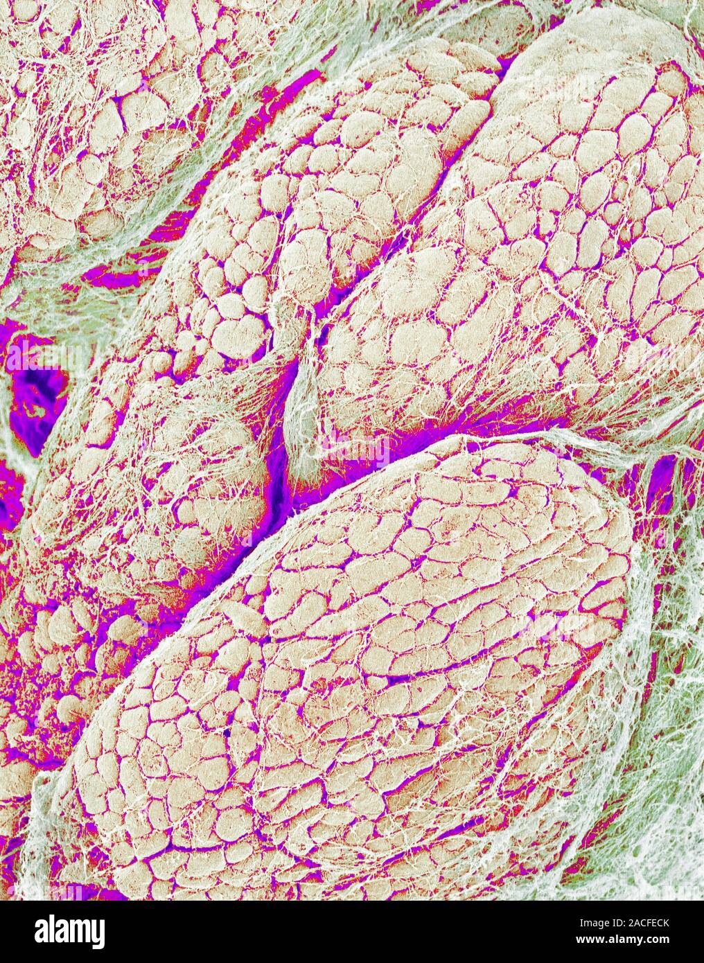 Pancreas surface, coloured scanning electron micrograph (SEM). Several ...