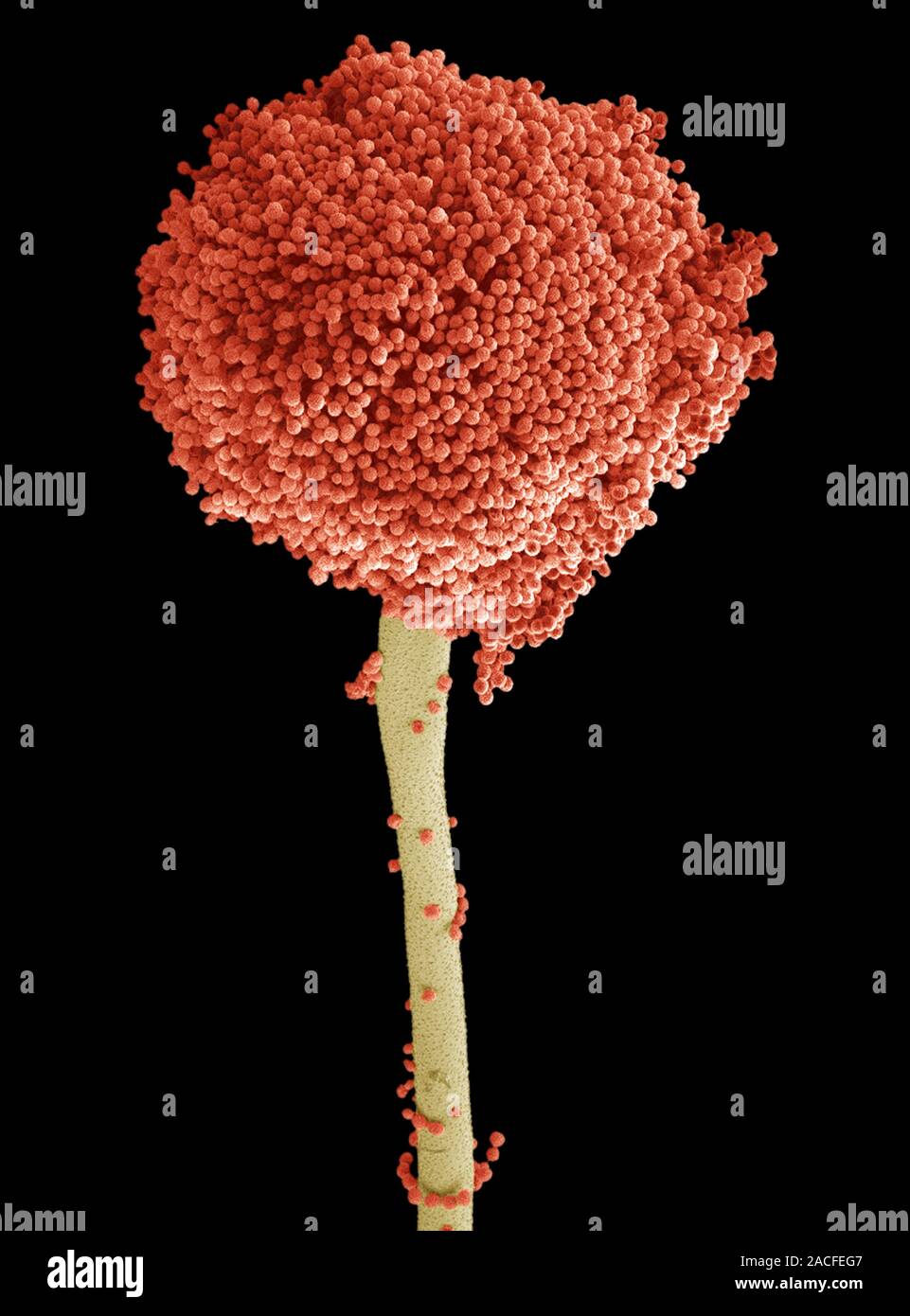 Aspergillus fungus. Coloured scanning electron micrograph (SEM) of the fruiting body (round, top ...