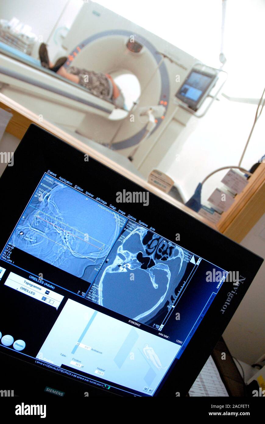 CT scanning. Patient undergoing a computed tomography (CT) scan. CT ...