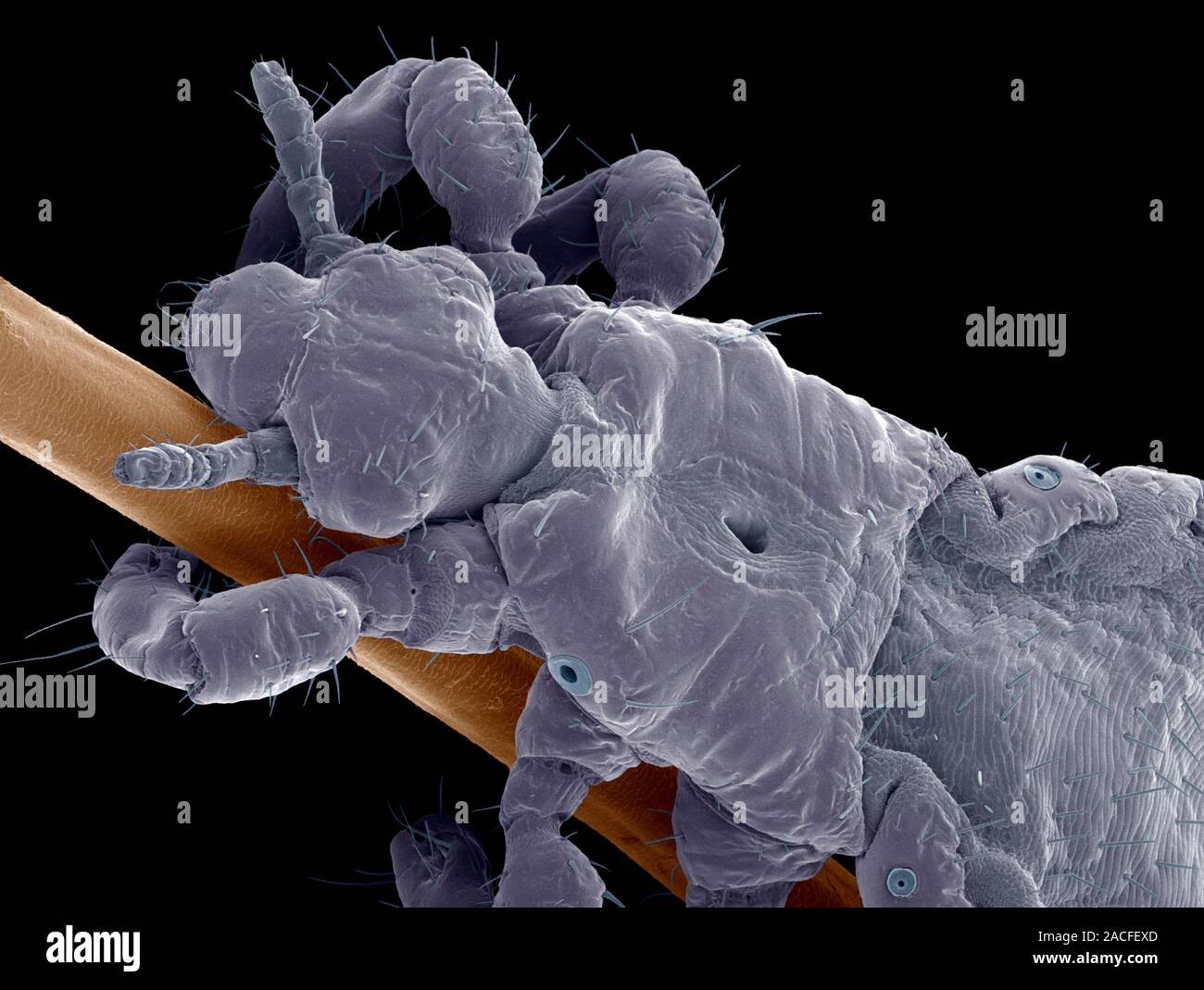 Head louse. Coloured scanning electron micrograph (SEM) of a head louse ...