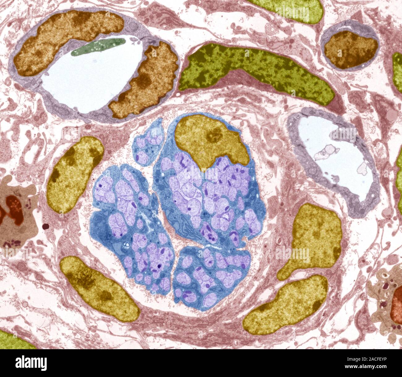 Unmyelinated nerve bundle. Coloured transmission electron micrograph ...