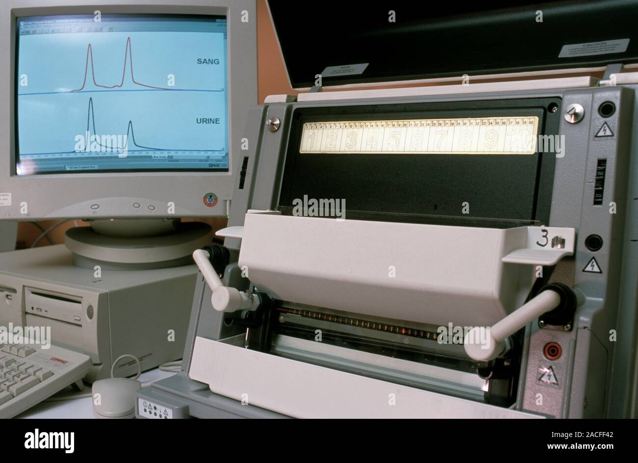Electrophoresis genetic analysis. Results of the analysis of DNA ...