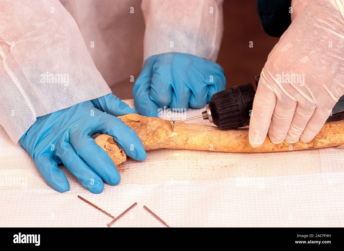 Islamic mummy research. Researchers using a bone saw to obtain a sample ...