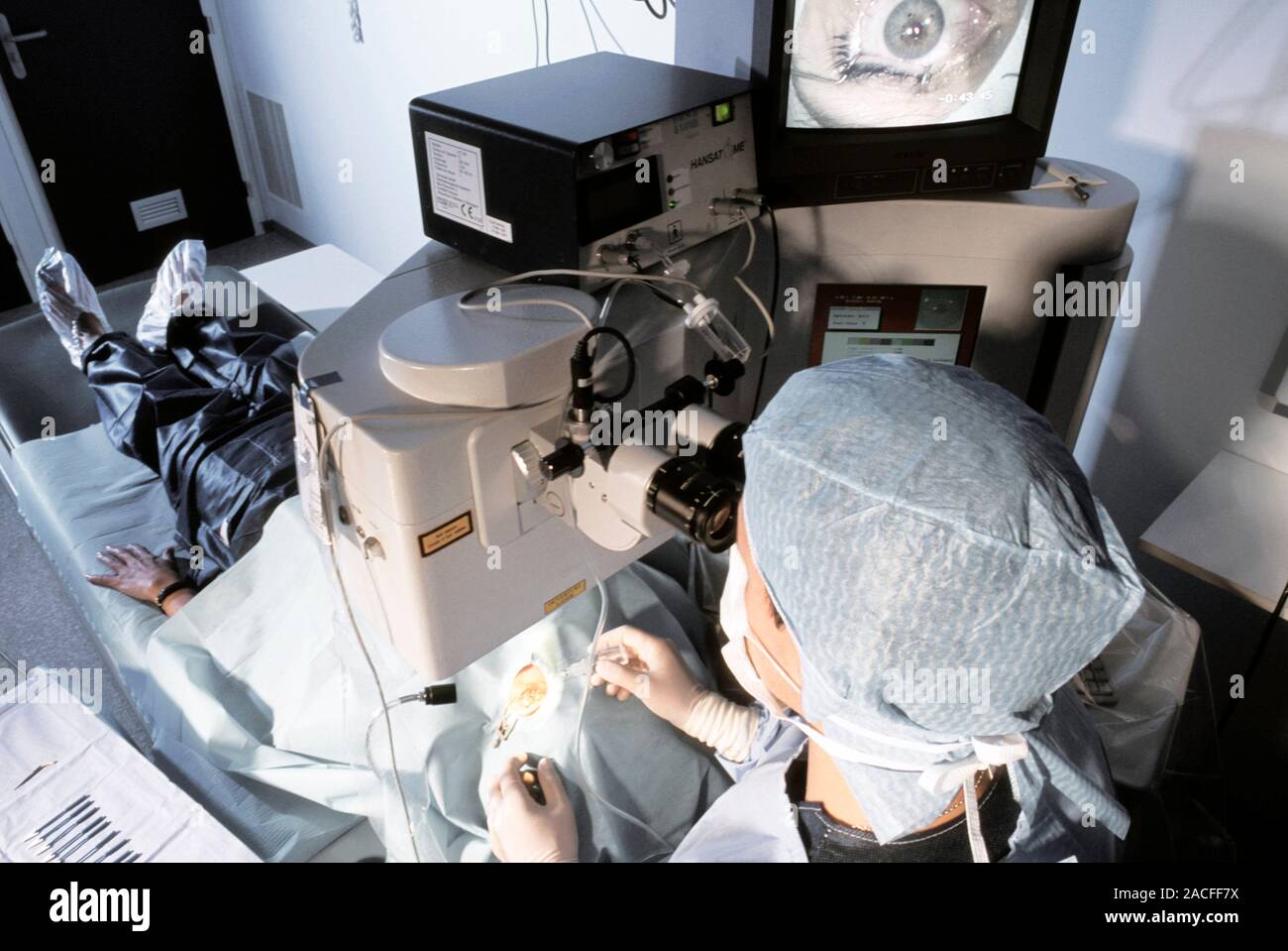 Laser eye surgery. Surgeon using a microscope device while carrying out ...