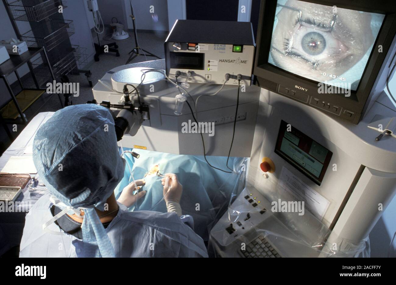 Laser eye surgery. Surgeon using a microscope device while carrying out ...