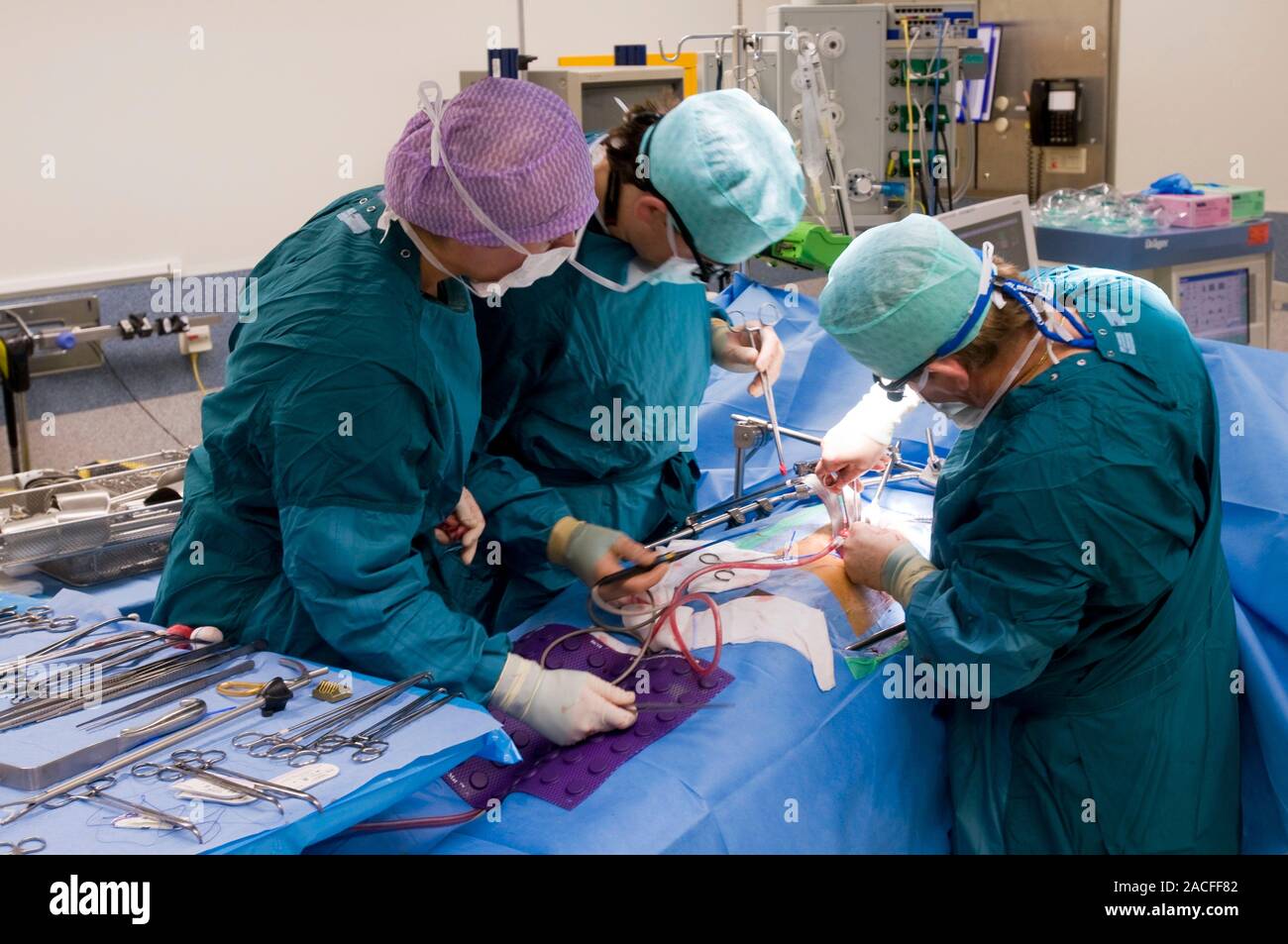Kidney transplant surgery. Surgeons removing a healthy kidney from a ...