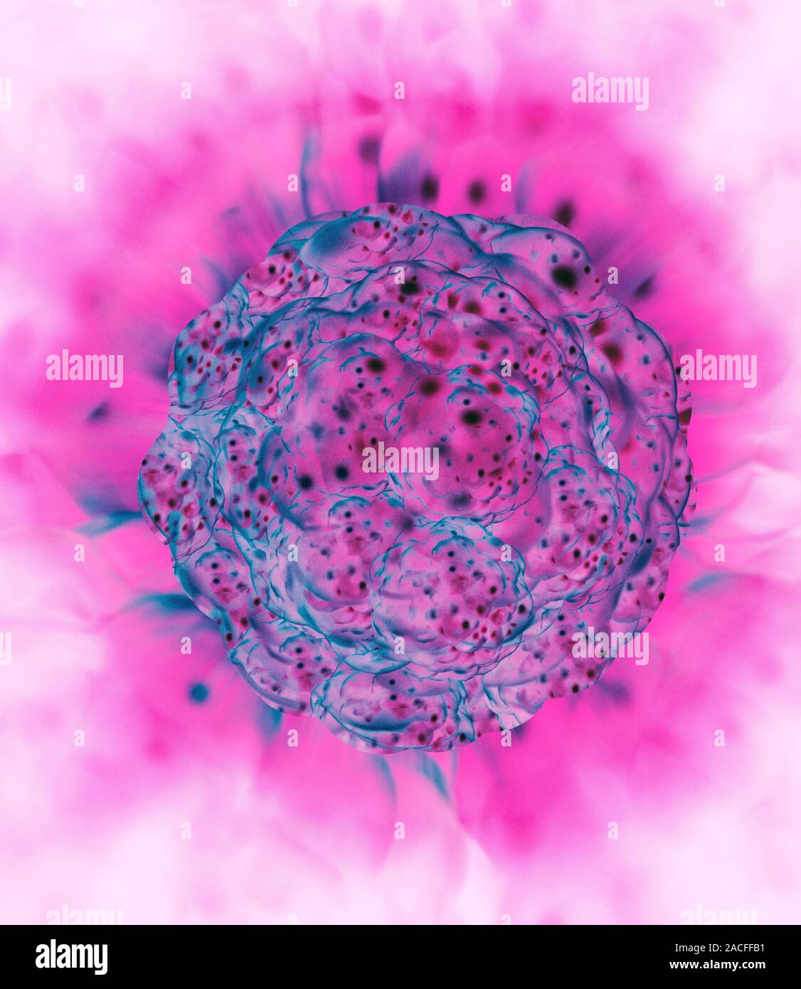 Cancer cell, computer artwork. The uneven surface of the cell is ...