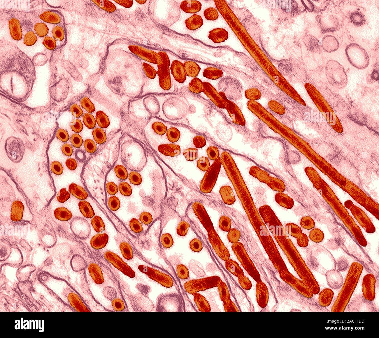 H5N1 avian influenza virus particles, coloured transmission electron ...