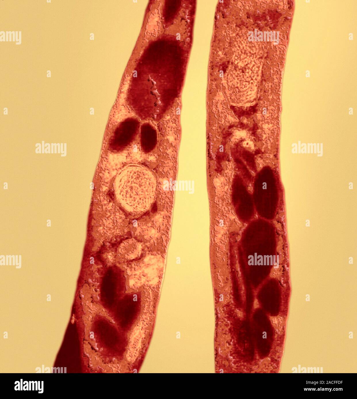 Anthrax bacteria. Coloured transmission electron micrograph of Bacillus ...