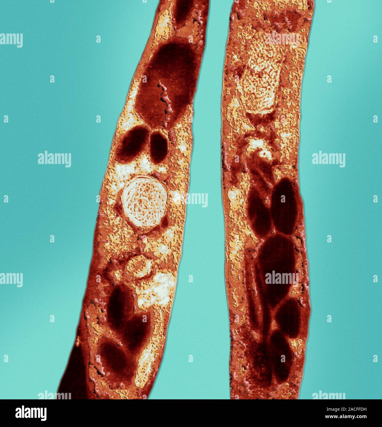 Anthrax bacteria. Coloured transmission electron micrograph of Bacillus ...