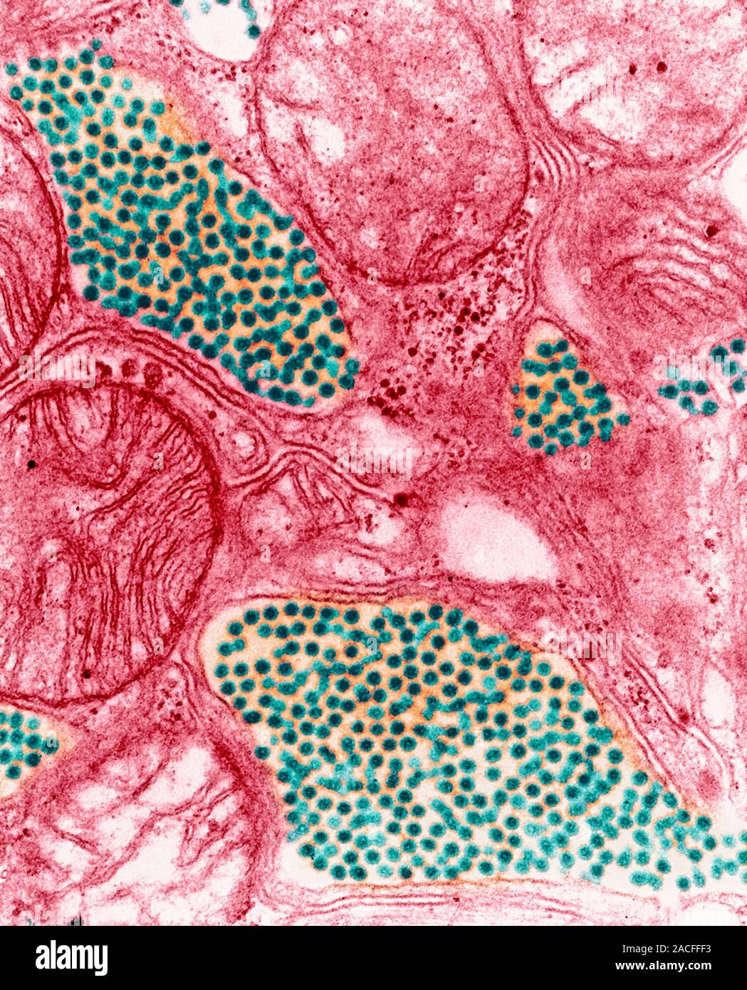 Eastern equine encephalitis virus. Coloured transmission electron ...