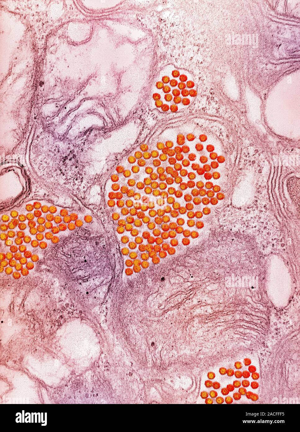 Eastern equine encephalitis virus. Coloured transmission electron ... Eastern equine encephalitis virus. Coloured transmission electron ...