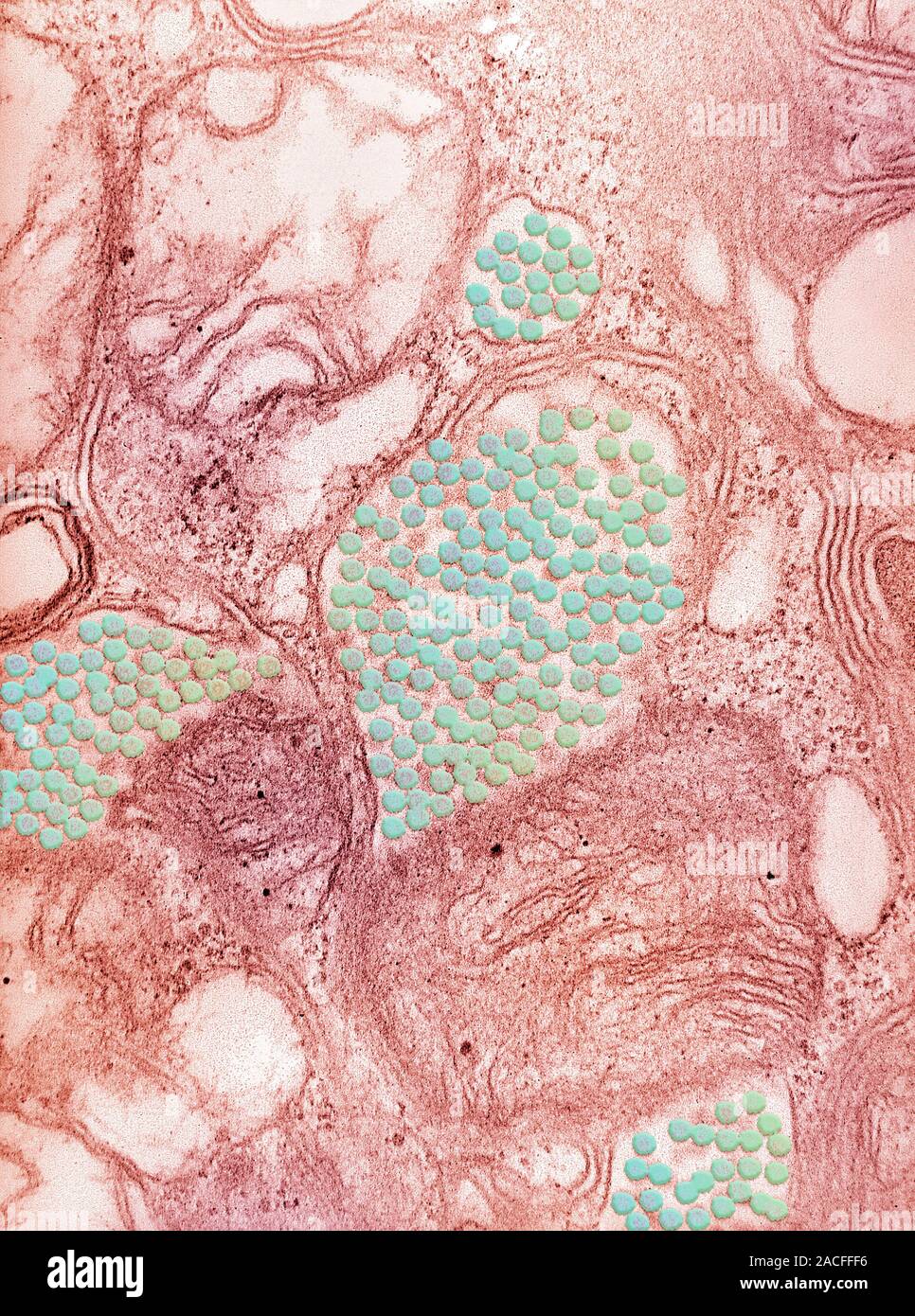 Eastern equine encephalitis virus. Coloured transmission electron ... Eastern equine encephalitis virus. Coloured transmission electron ...