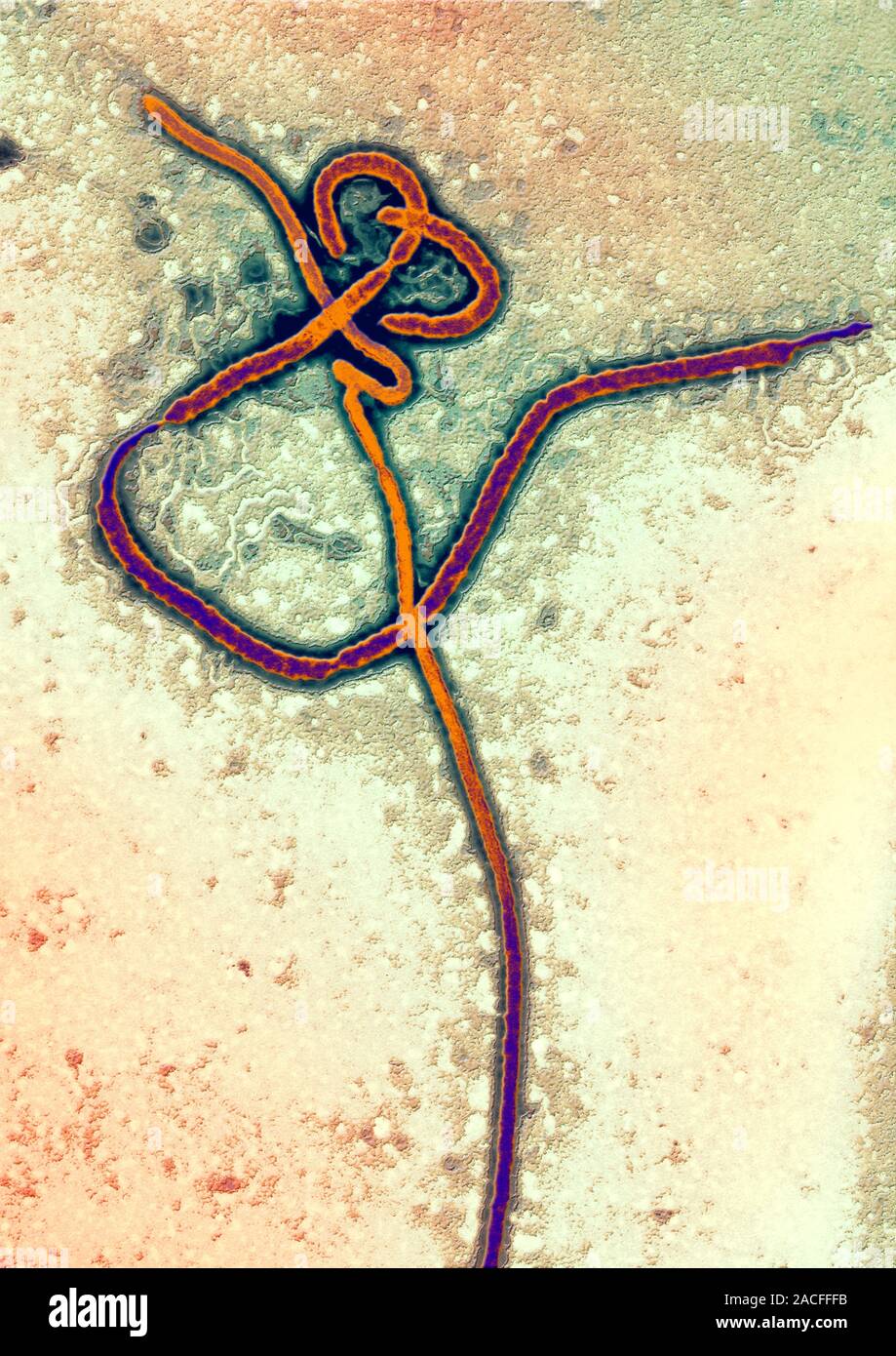 Ebola virus particles, coloured transmission electron micrograph (TEM ...