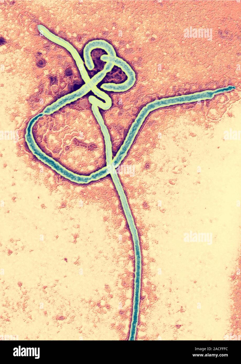 Ebola virus particles, coloured transmission electron micrograph (TEM ...