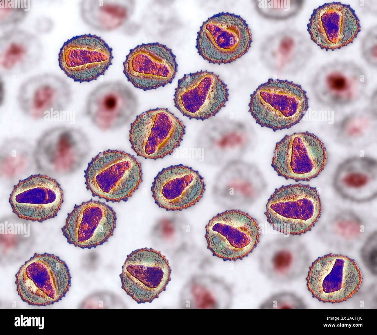 HIV (human immunodeficiency virus) particles, coloured transmission ...