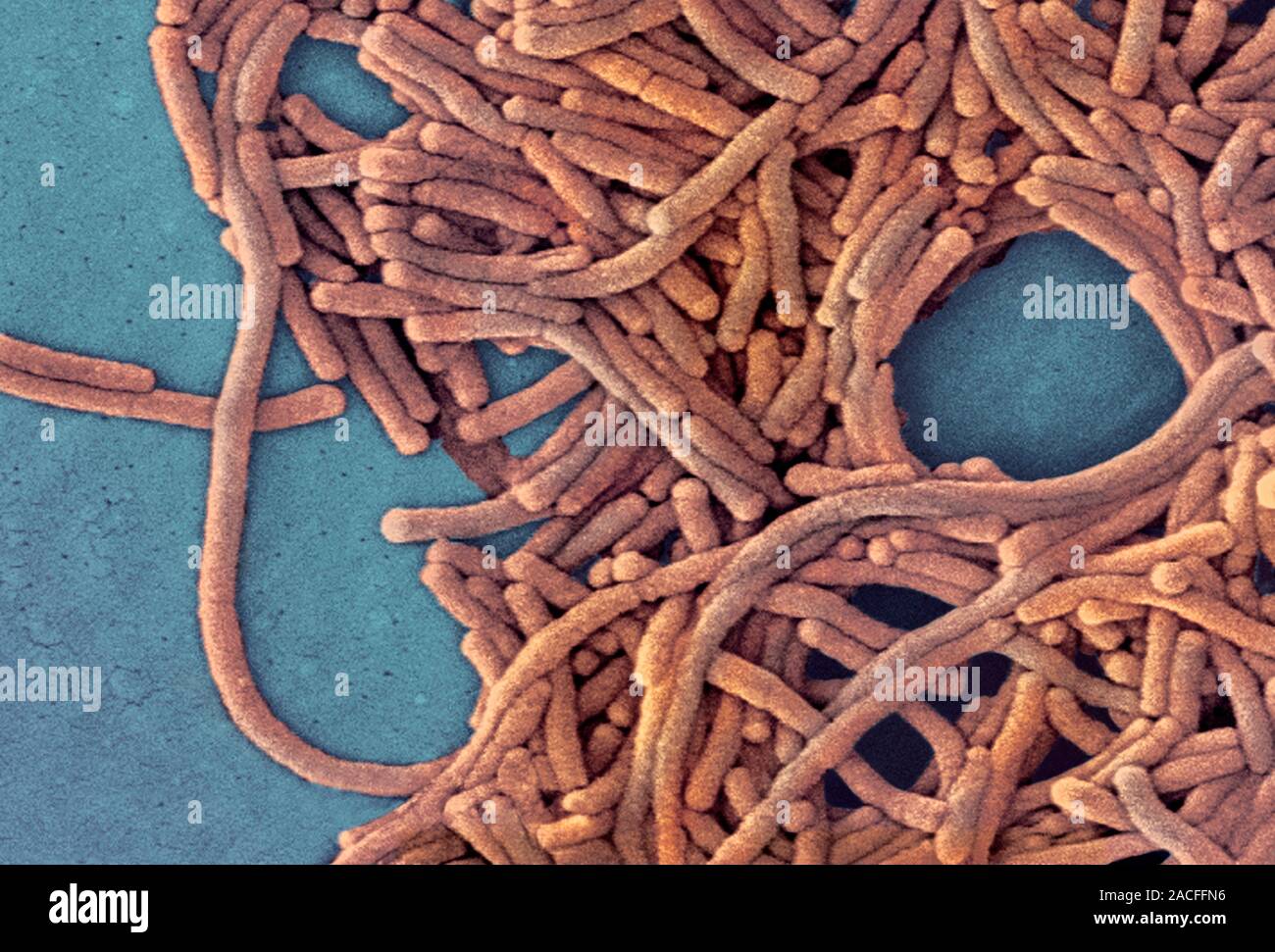 Legionella bacteria. Coloured scanning electron micrograph (SEM) of ...