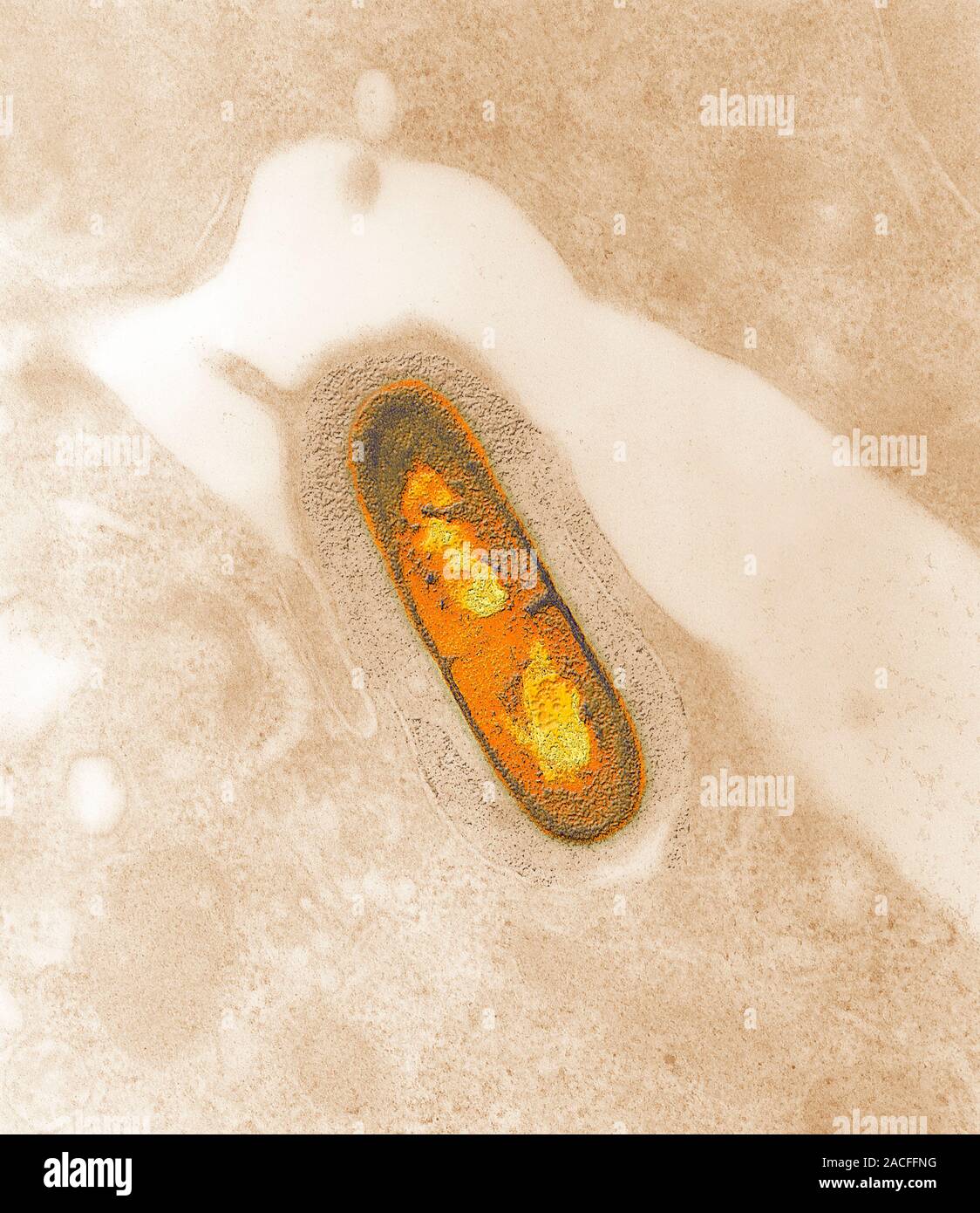 Listeria sp. bacteria, coloured transmission electron micrograph (TEM ...