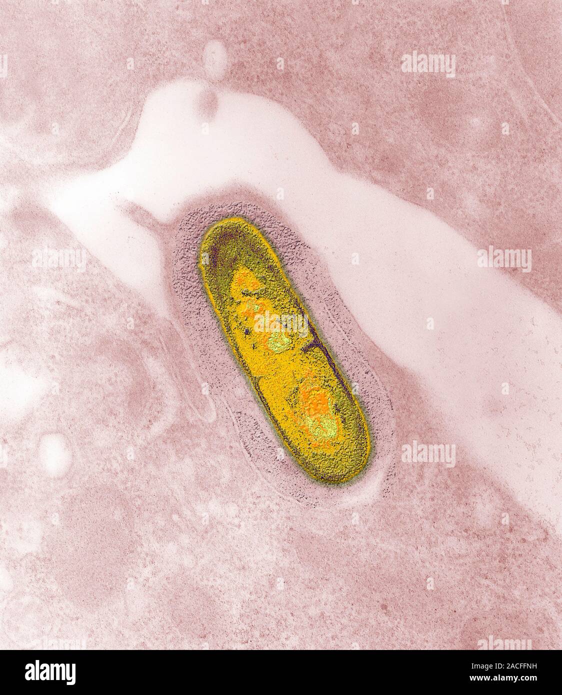 Listeria sp. bacteria, coloured transmission electron micrograph (TEM ...