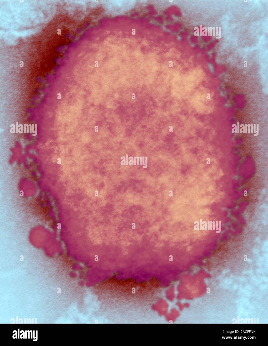 Monkeypox virus particle, coloured transmission electron micrograph ...
