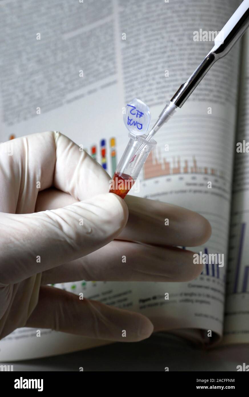 DNA research. Researcher using a pipette (silver) to add a sample of ...
