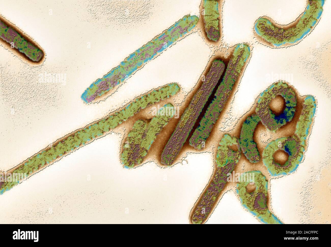 Marburg virus, coloured transmission electron micrograph (TEM). This ...