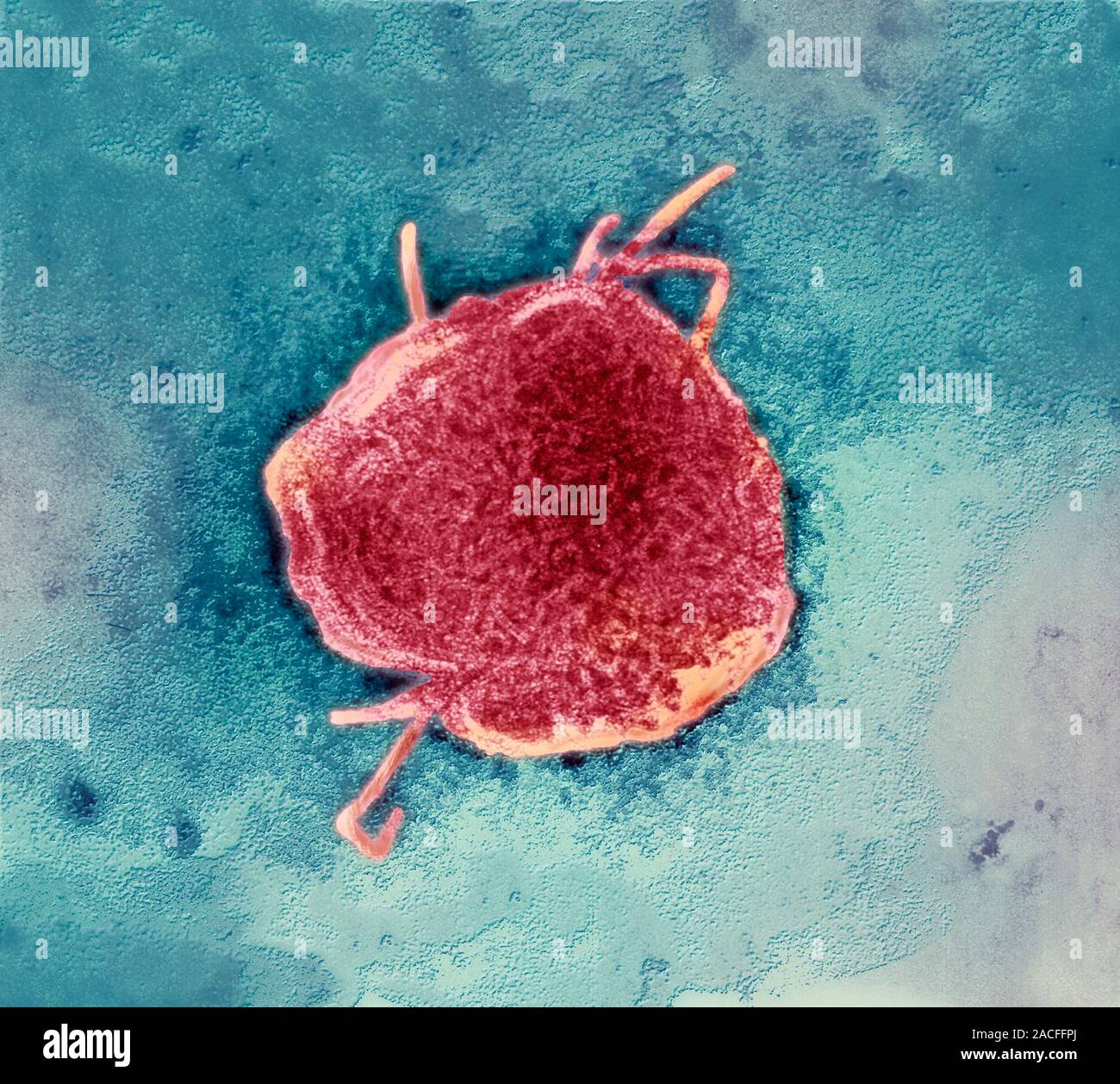Measles virus particle, coloured transmission electron micrograph (TEM ...