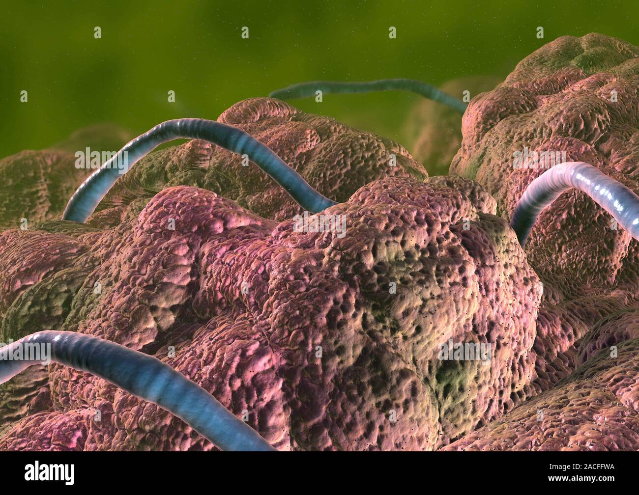 Intestinal parasites, computer artwork. Parasitic worms embedded in the ...