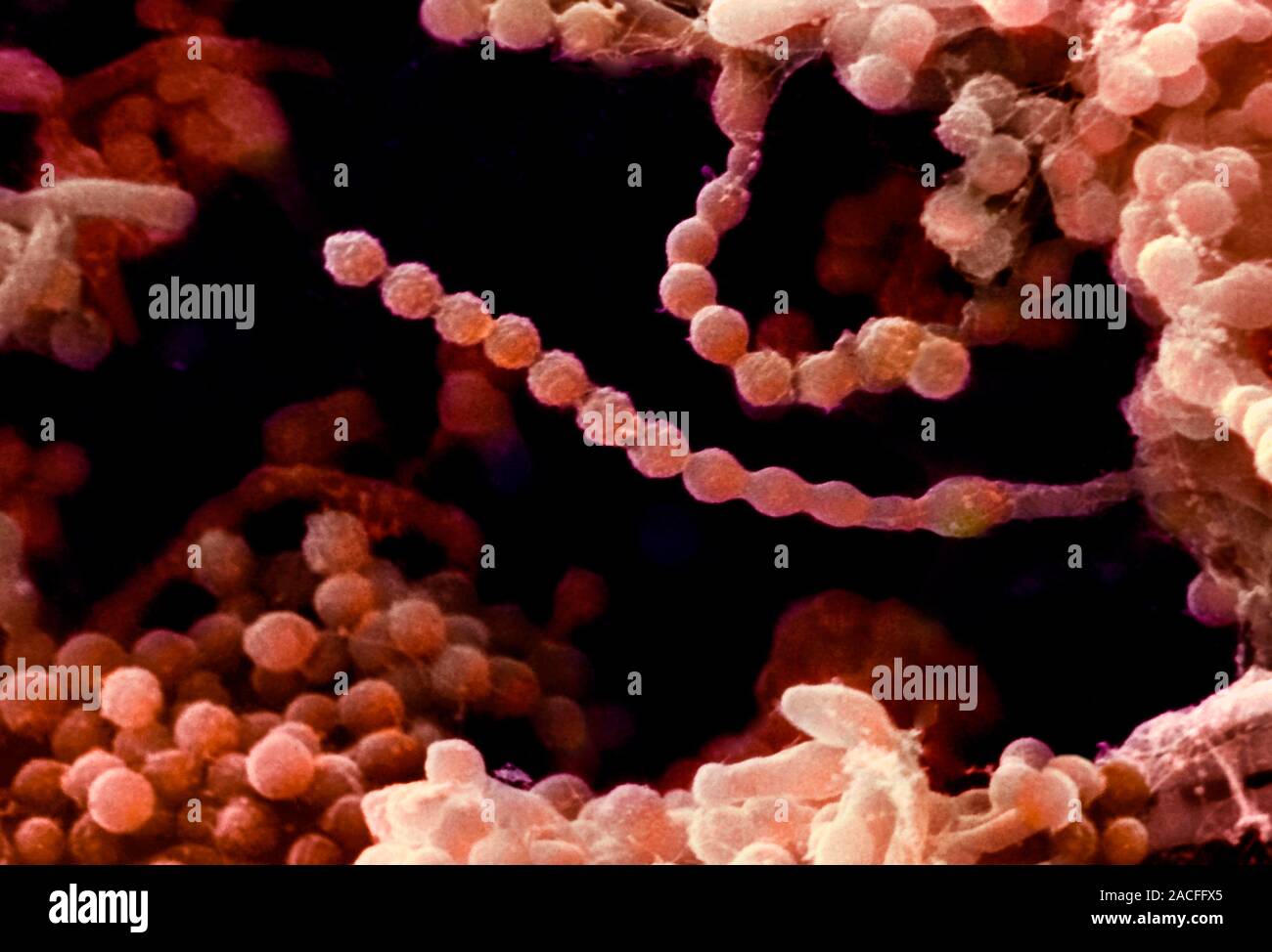 Nematode-killing fungus. Coloured scanning electron micrograph (SEM) of ...