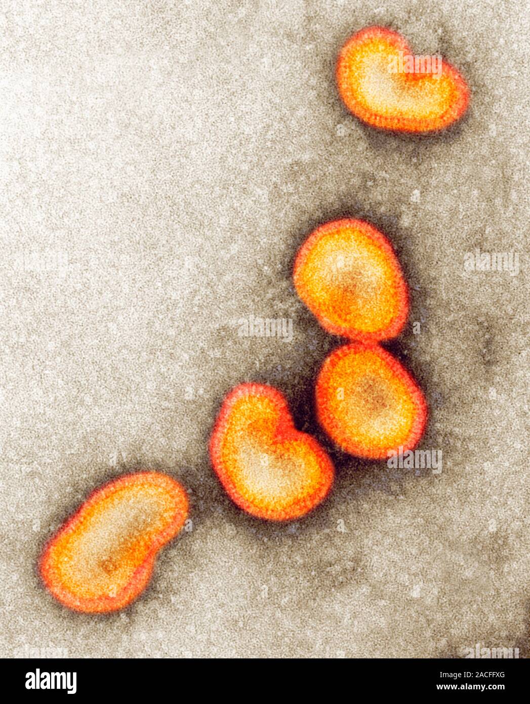 H1N1 Influenza A virus particles, coloured transmission electron ...