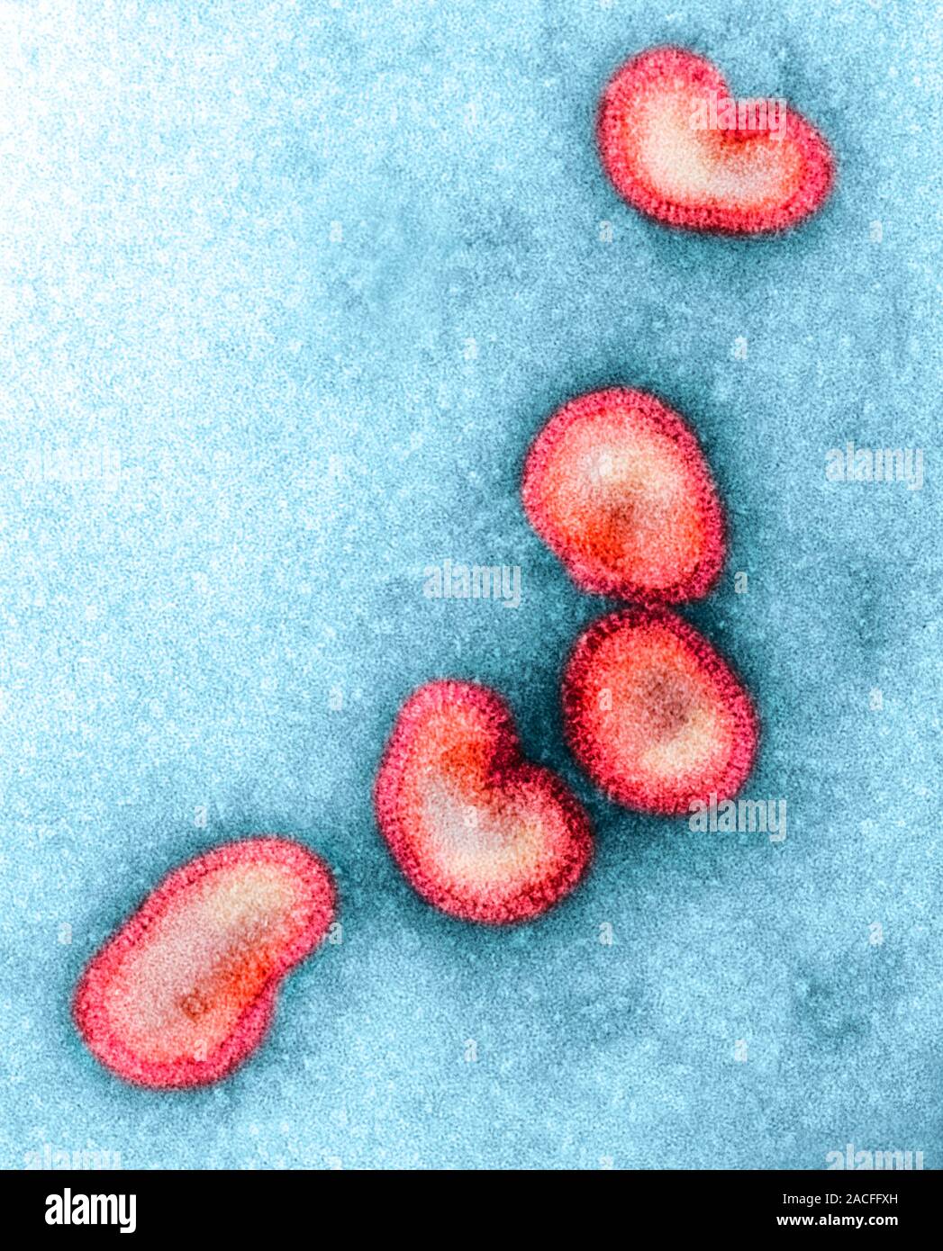 H1N1 Influenza A virus particles, coloured transmission electron ... H1N1 Influenza A virus particles, coloured transmission electron ...