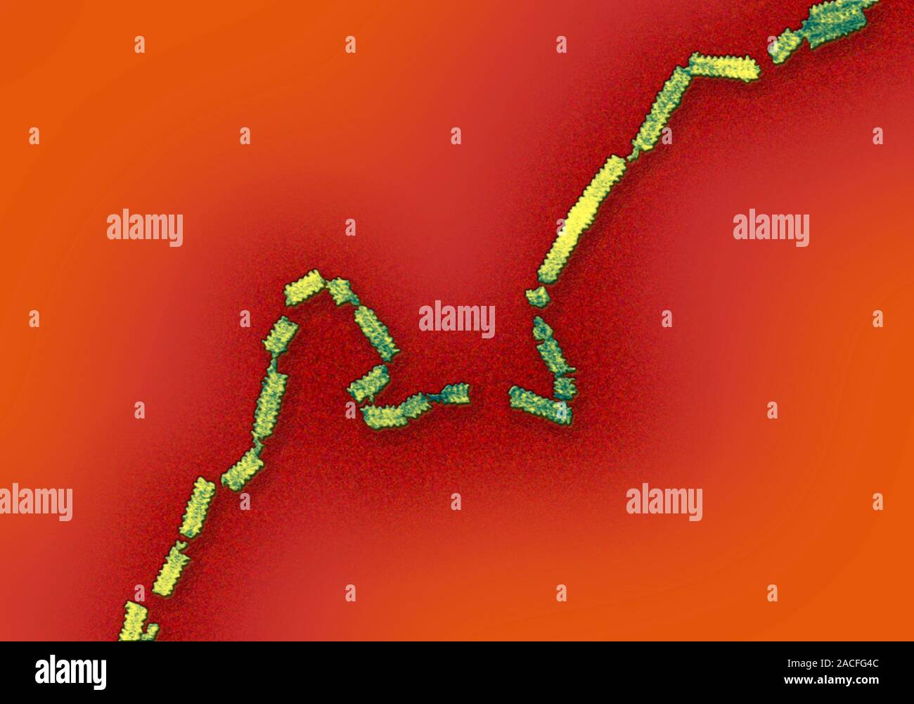 Human parainfluenza virus. Transmission electron micrograph (TEM) of ribonuclear protein helices ...